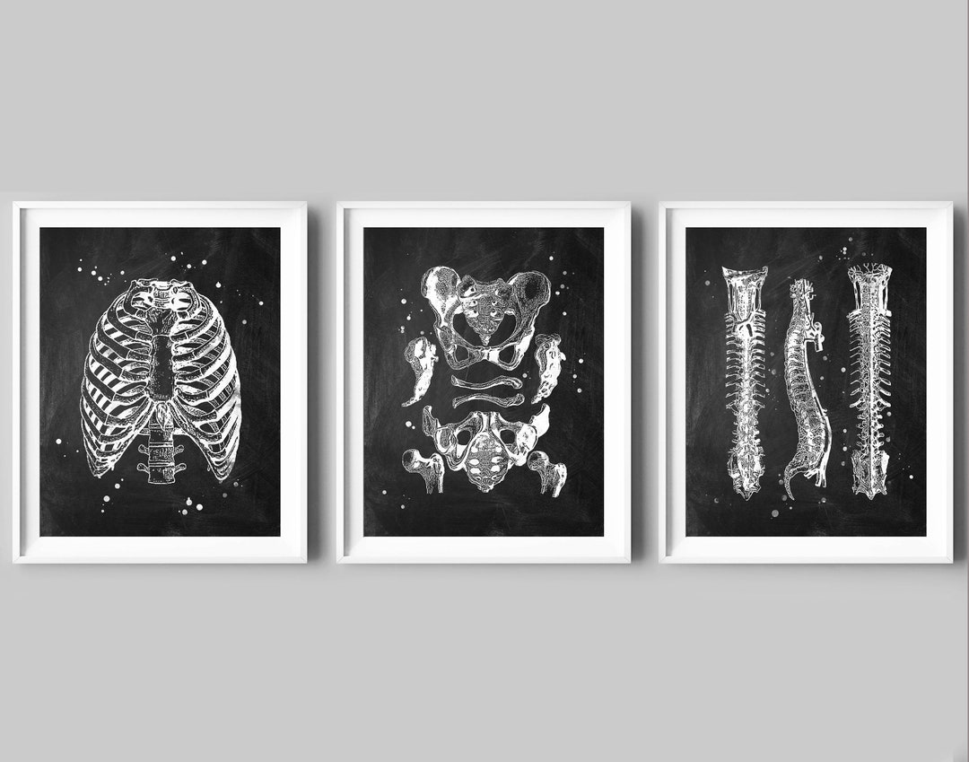 3 Skeletal System Anatomy Art Medical Art Chalkboard Art Rib Cage Print ...