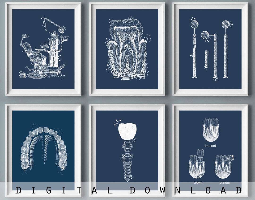 Dentistry Poster Set 6, Dental Art, Tooth Anatomy Decor, Medical Decor ...