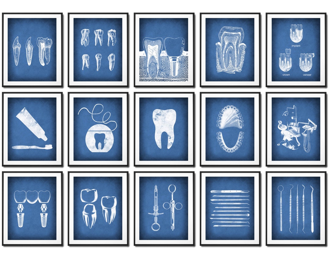 15 Dental Art Tooth Anatomy Poster Medical Art Dental Anatomy Artwork ...