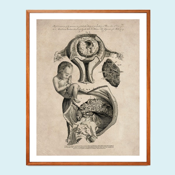 Placenta Print - Etsy