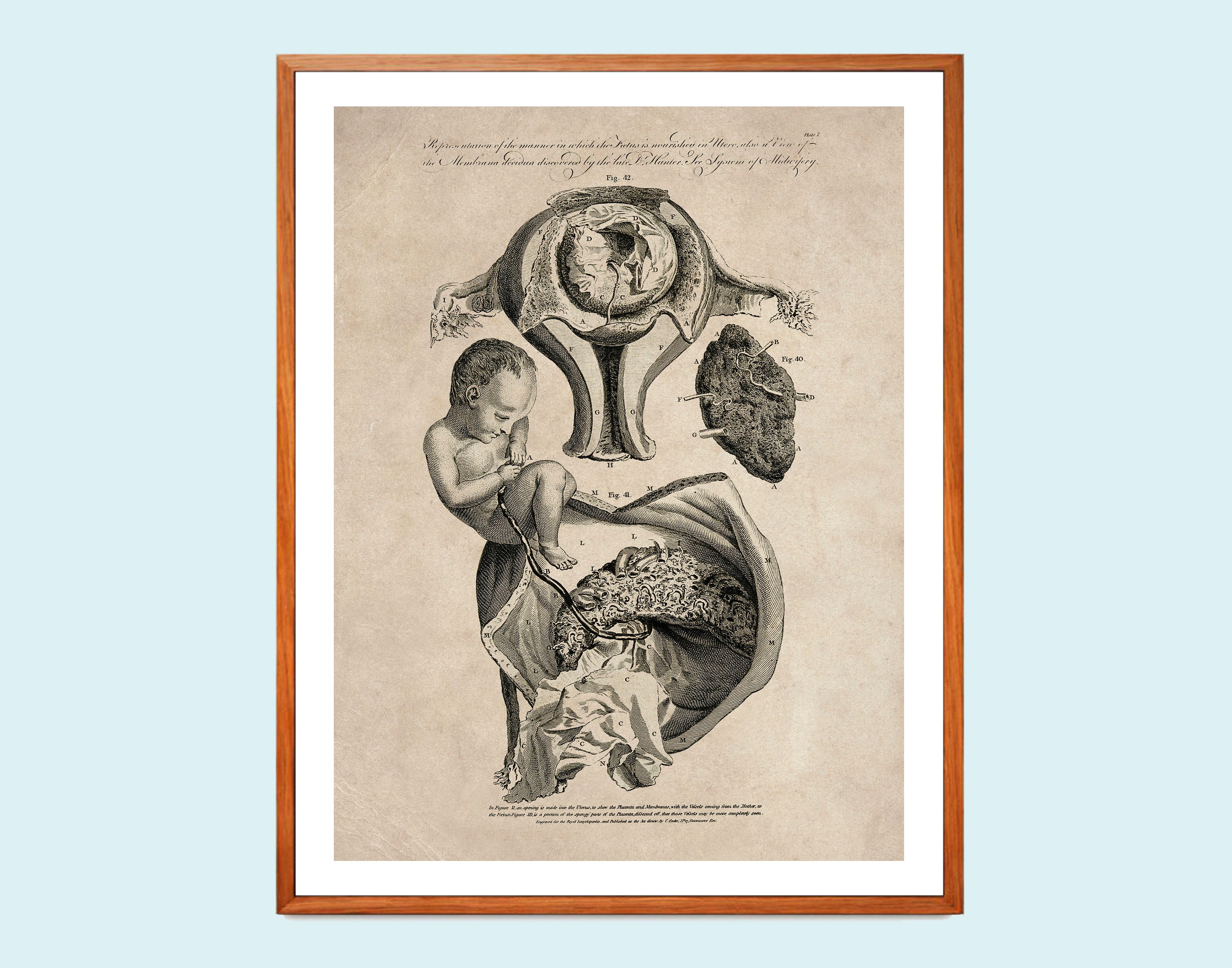 OBGYN vintage art Medical poster Fetus print Baby in womb | Etsy