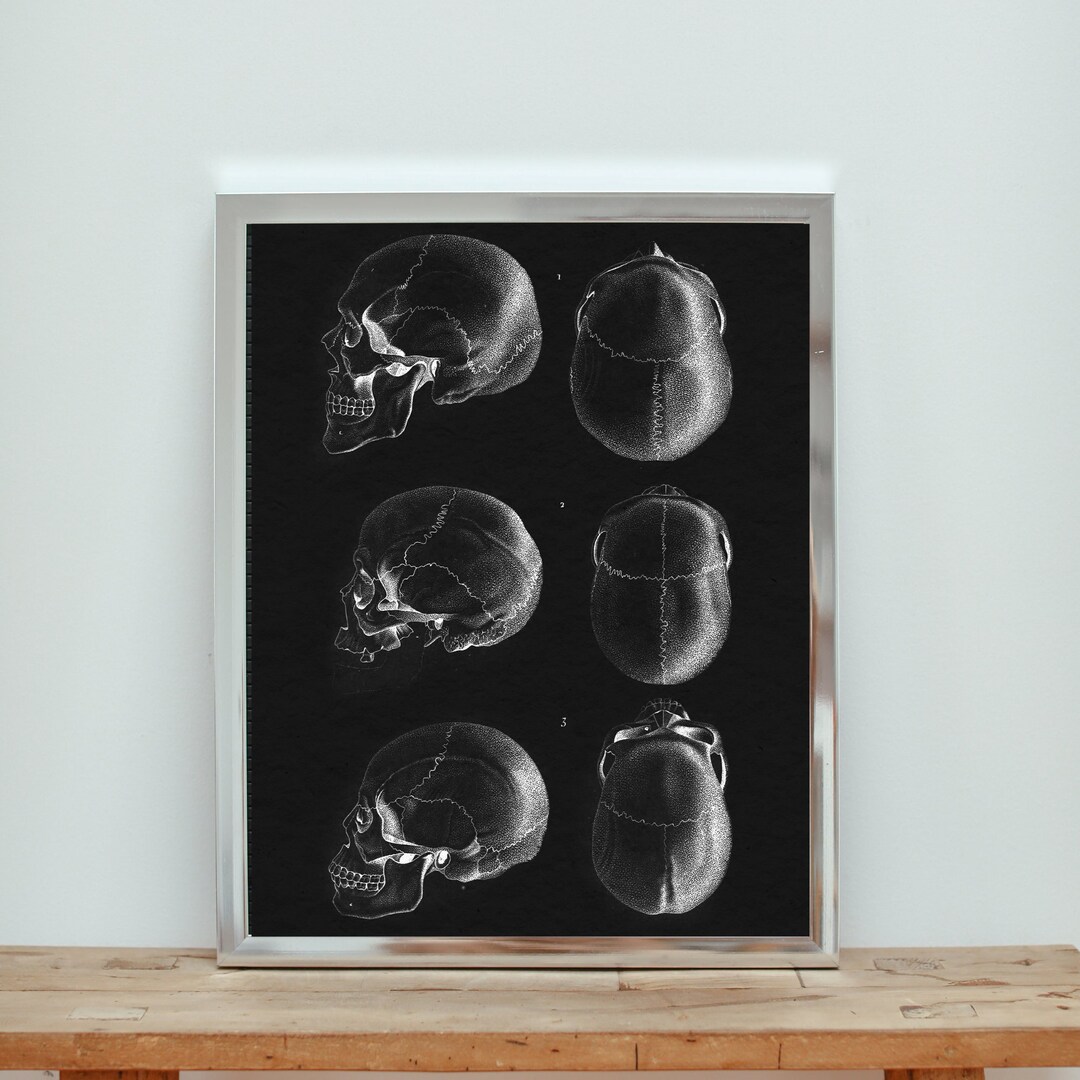 Human Skull Patent Drawing Poster Human Anatomy Print / - Etsy