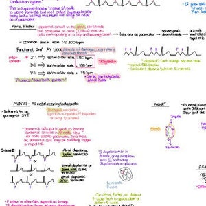 Arrhythmias, ECG Wave Morphologies, Coronary Syndromes, Atrial ...