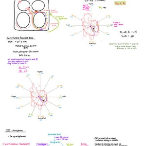 Arrhythmias, ECG Wave Morphologies, Coronary Syndromes, Atrial ...