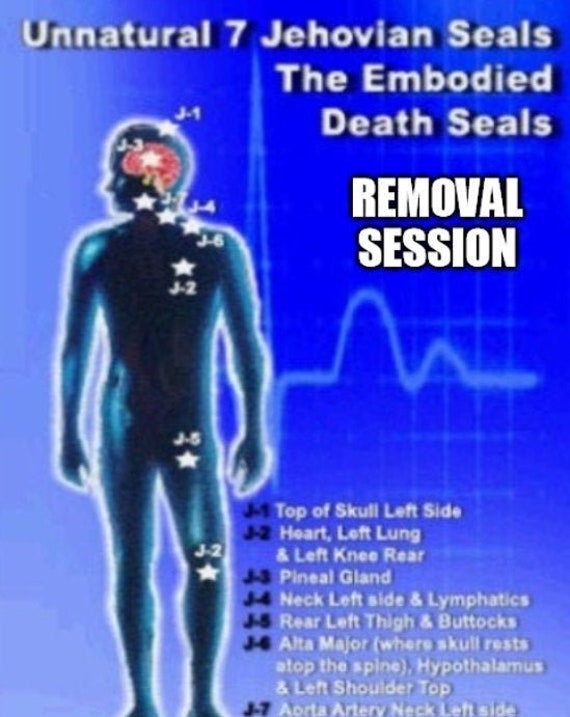 Jseals & Unnatural Implants/seals Removal - Etsy