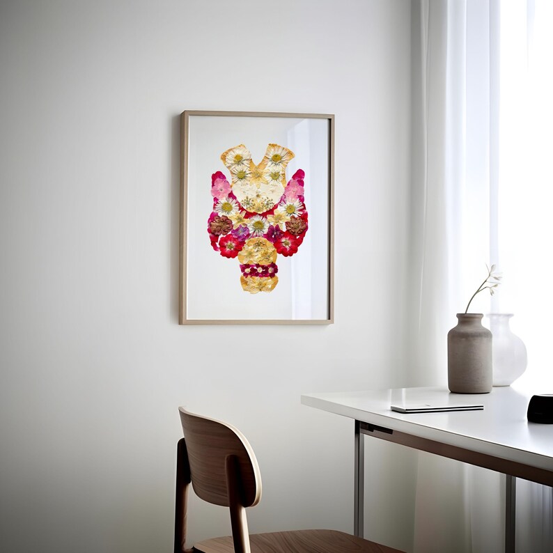 Thyroid Anatomy Print Endocrinologist Office Decor Medical Wall Art ...