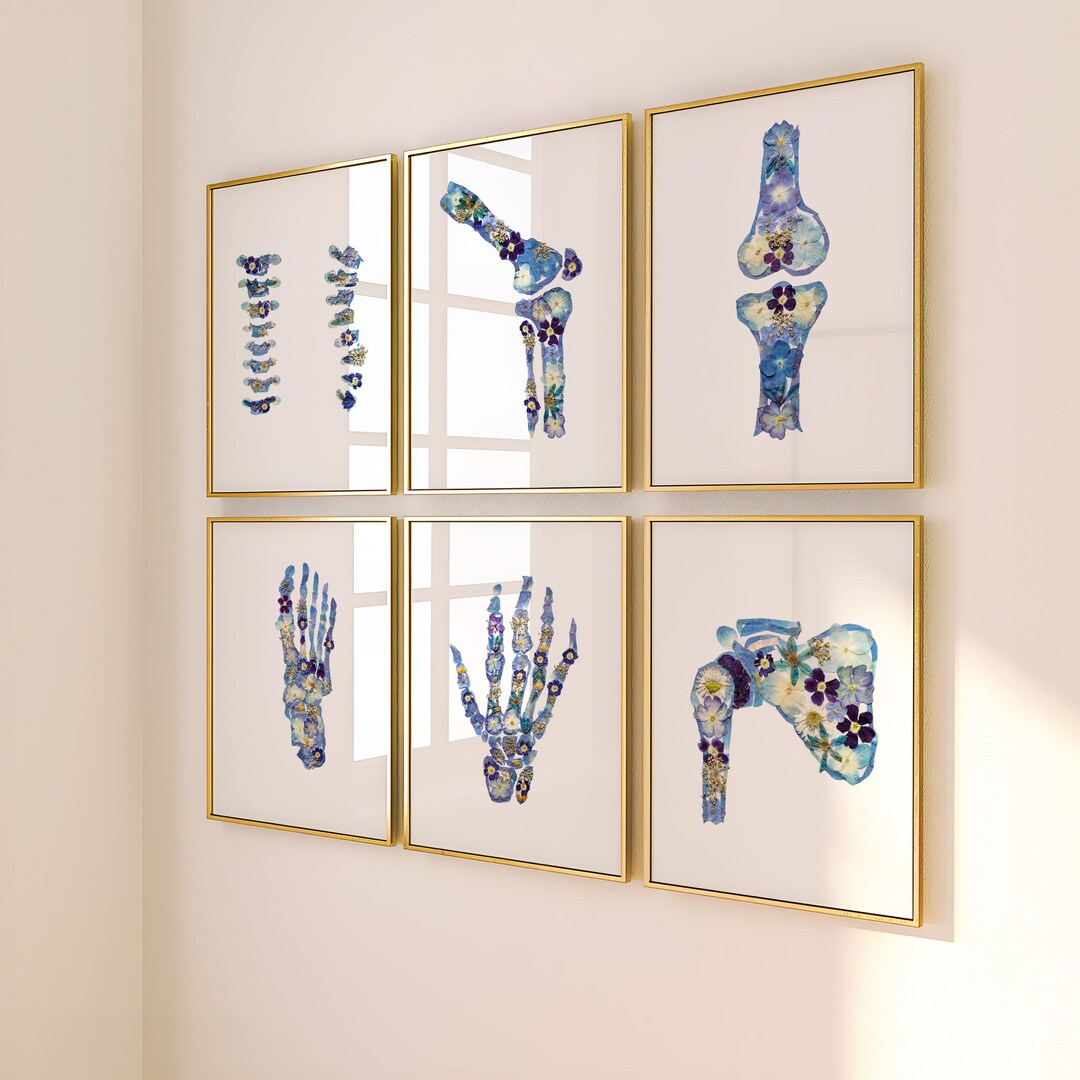 Orthopedic & Trauma Wall Art Prints – Set of 6 Physical Prints Medical ...
