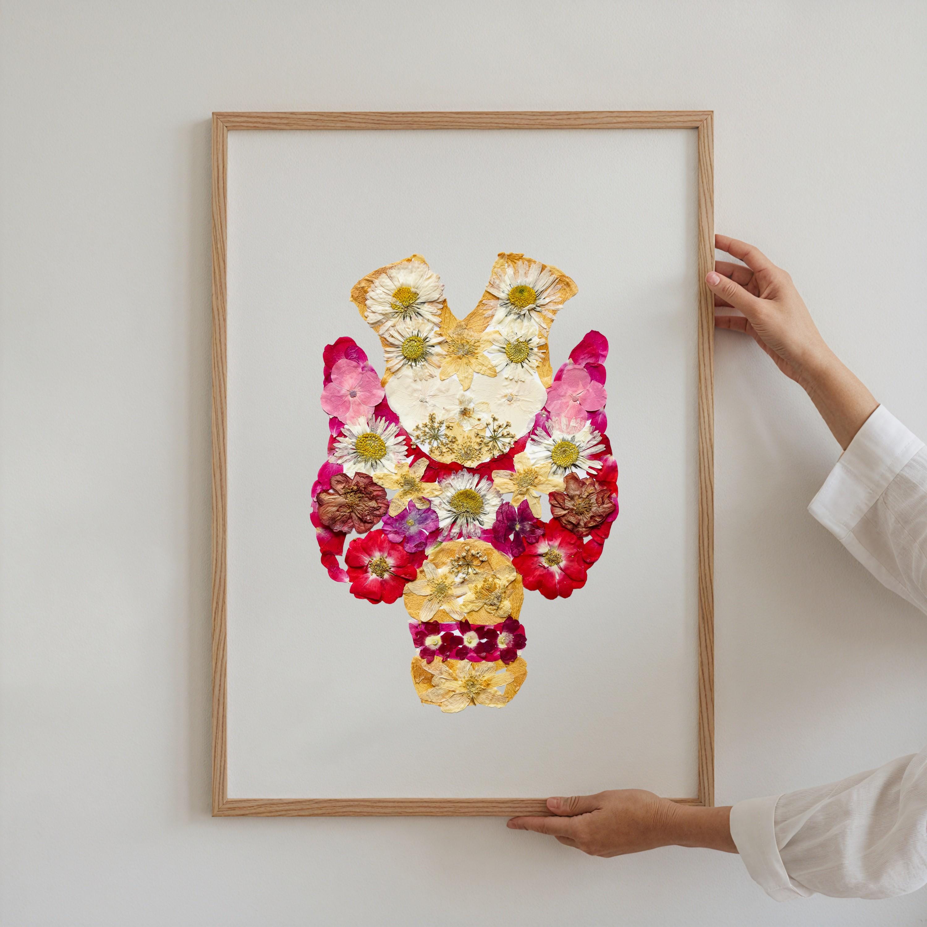 Thyroid Anatomy Print Endocrinologist Office Decor Medical Wall Art ...