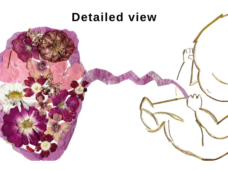 Digital Birth Anatomy Art – Baby With Placenta | Medical Wall Print for ...