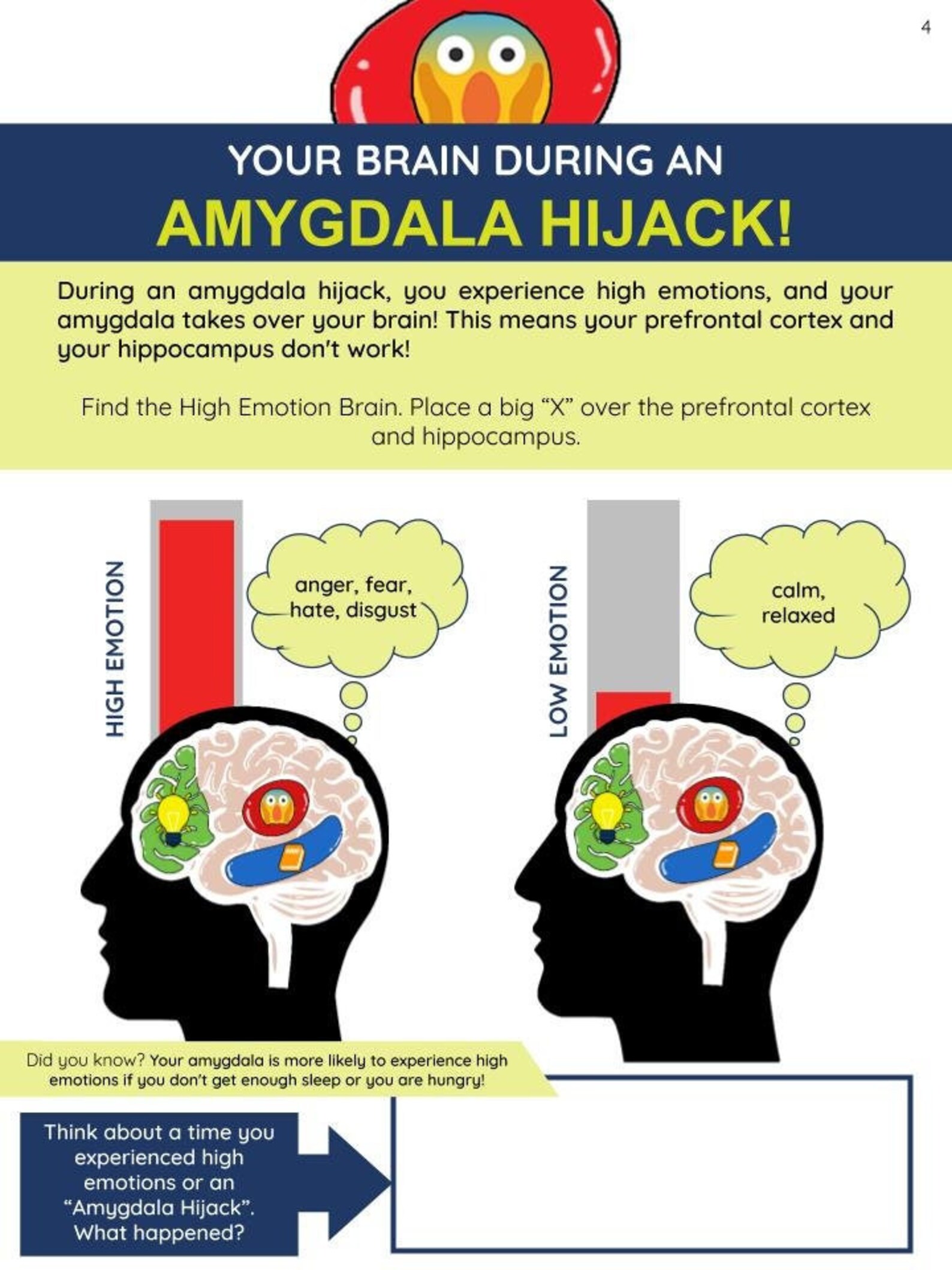 Your Brain and Body During an Amygdala Hijack - Etsy