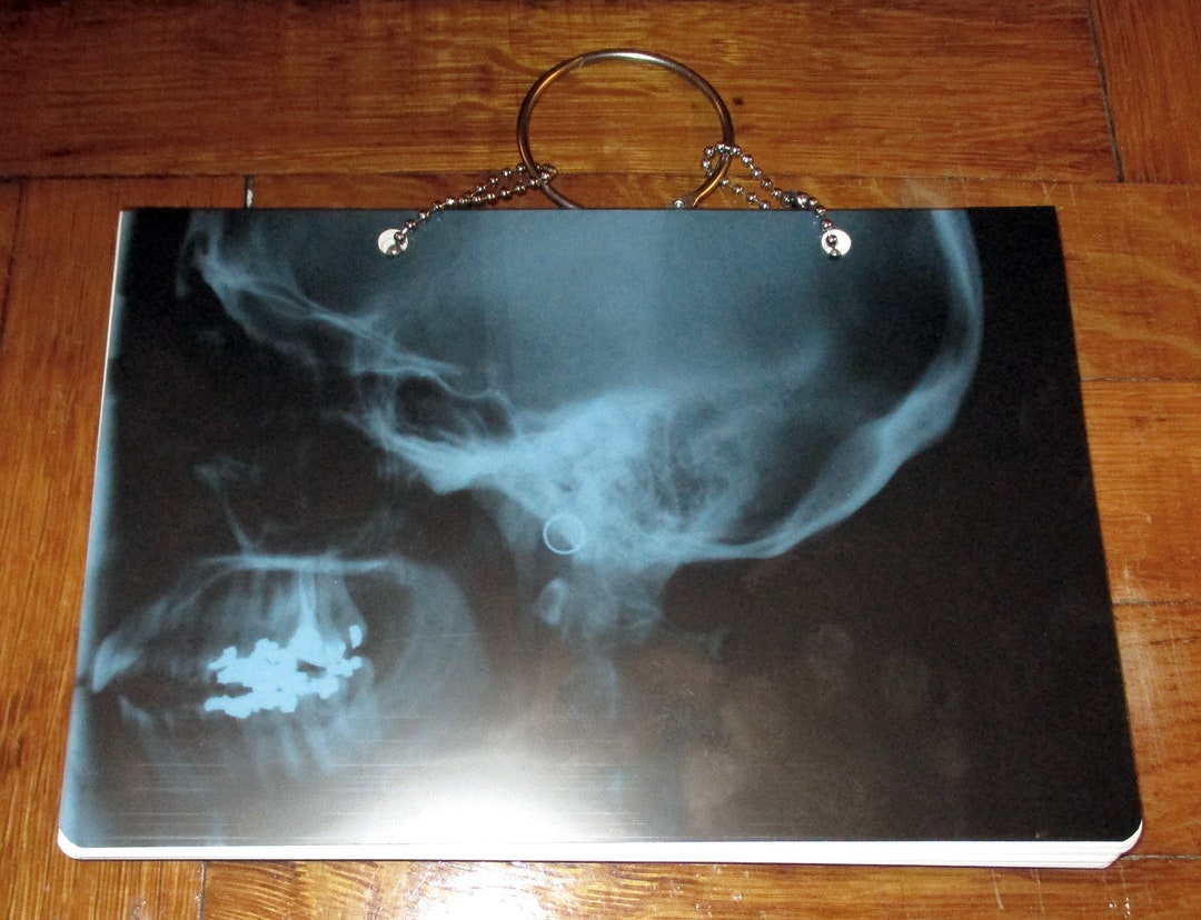Recycled X-ray Cover Sketchbook - Etsy