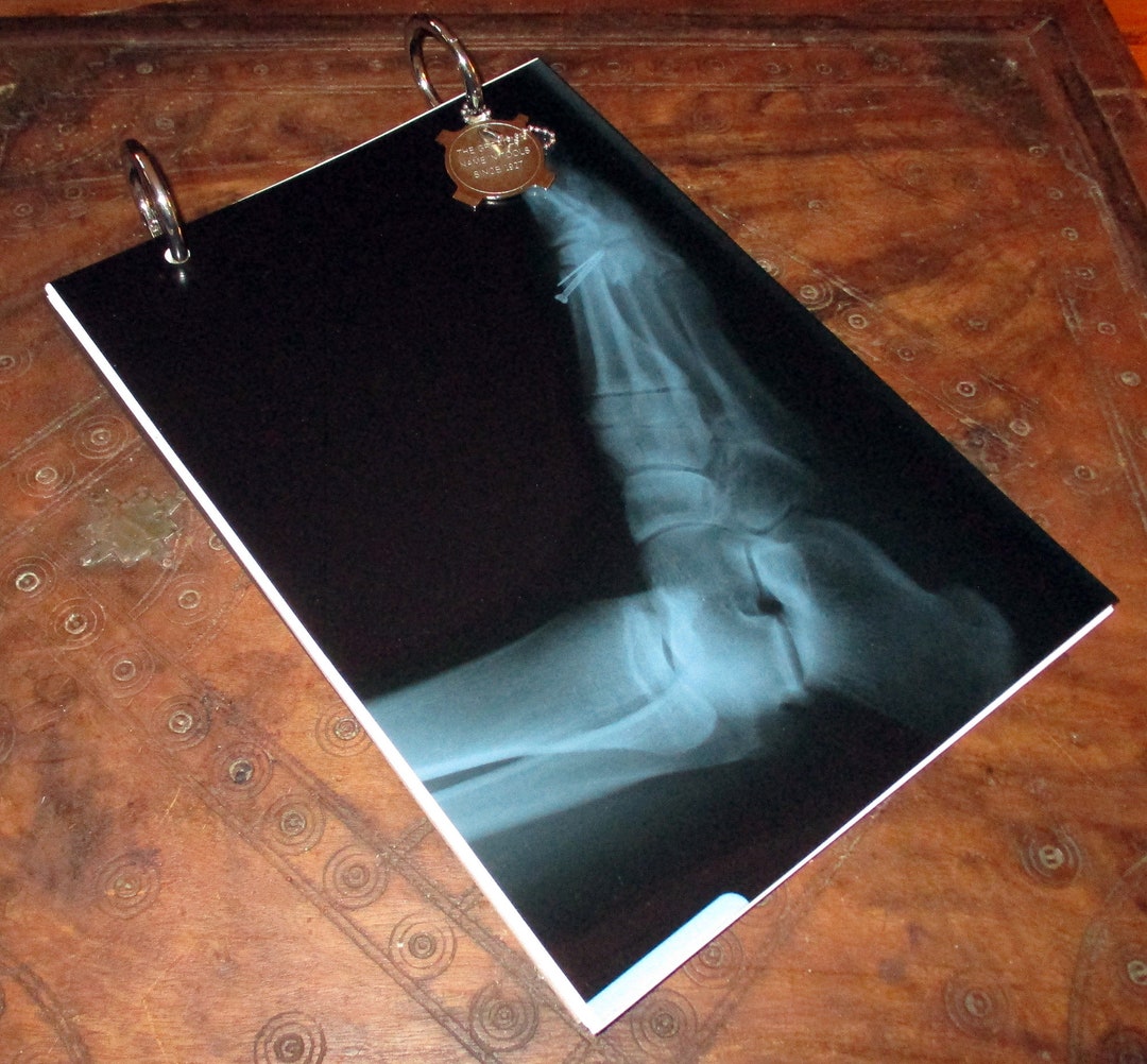 Recycled X-ray Cover Sketchbook - Etsy