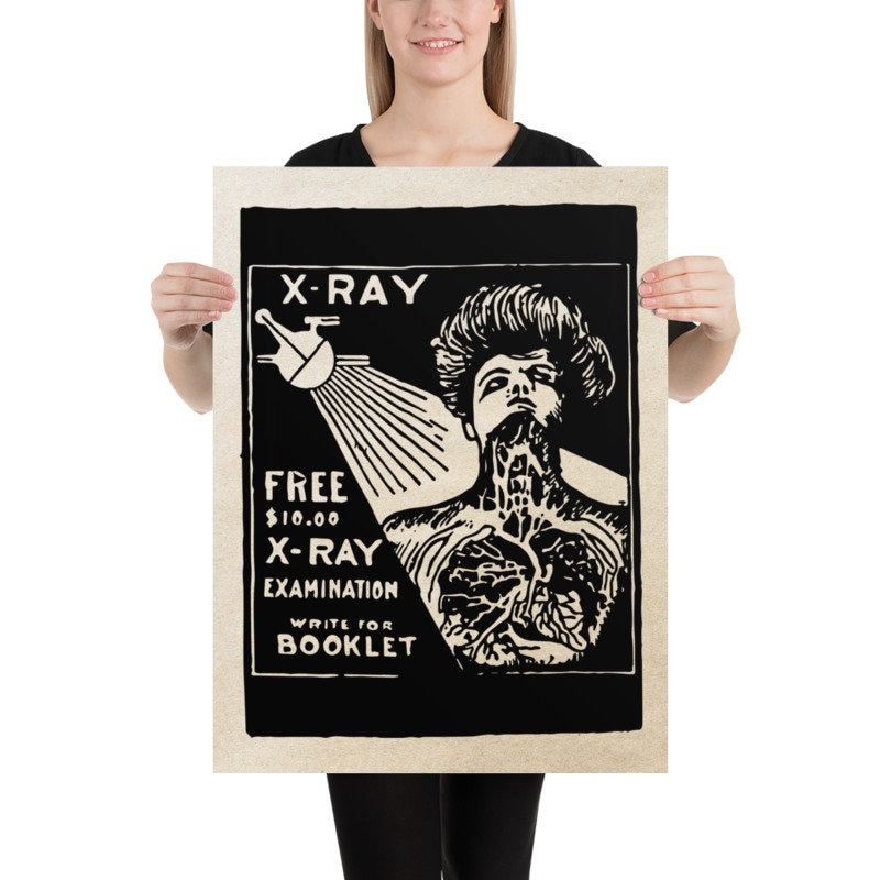Vintage X-ray Digital Poster | 1917 | INSTANT DOWNLOAD | Medical Poster ...