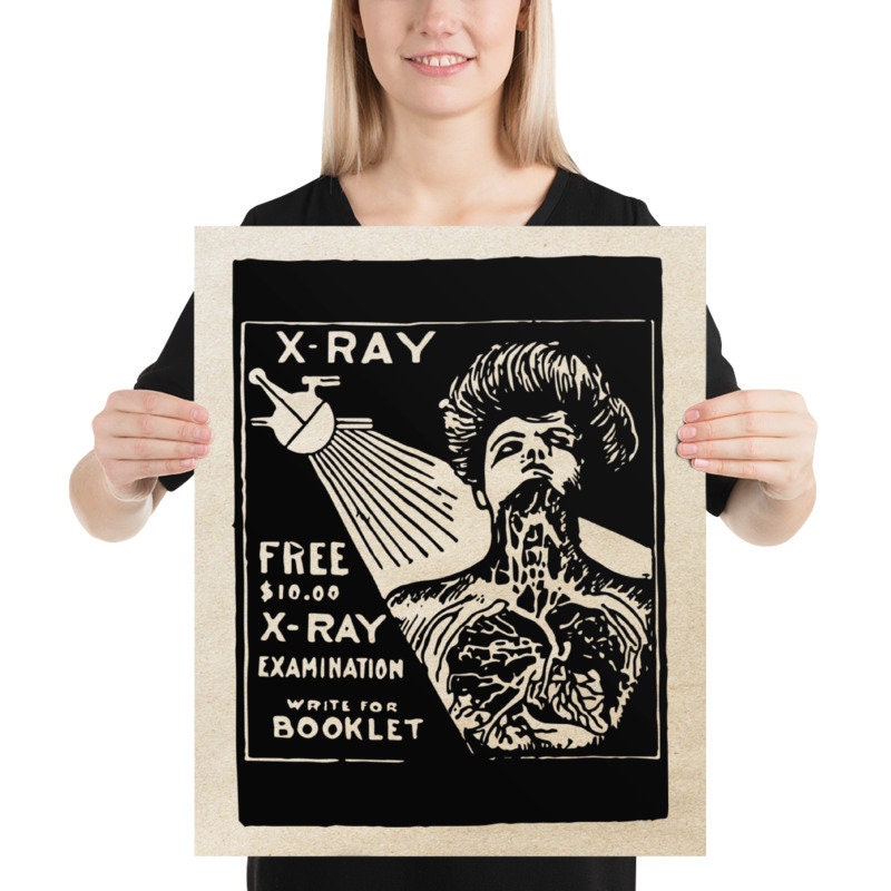 Vintage X-ray Digital Poster | 1917 | INSTANT DOWNLOAD | Medical Poster ...