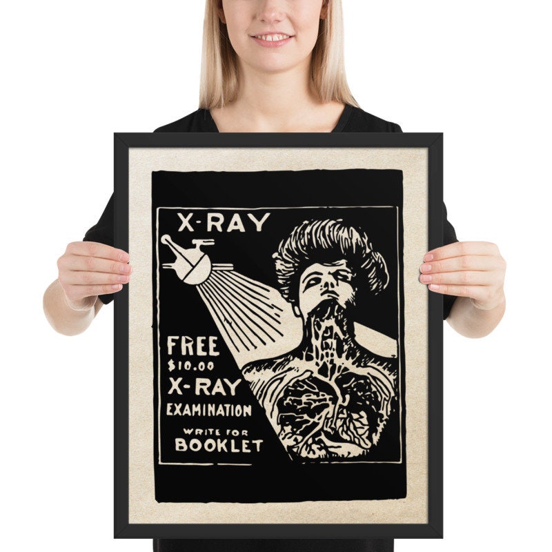 Vintage X-ray Digital Poster | 1917 | INSTANT DOWNLOAD | Medical Poster ...