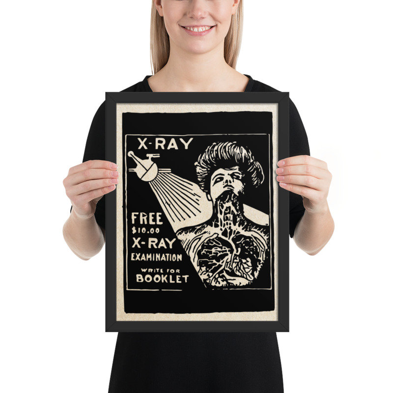 Vintage X-ray Digital Poster | 1917 | INSTANT DOWNLOAD | Medical Poster ...
