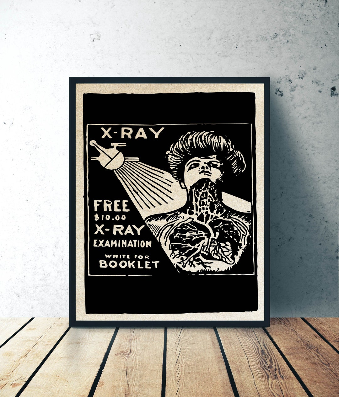 Vintage X-ray Digital Poster | 1917 | INSTANT DOWNLOAD | Medical Poster ...