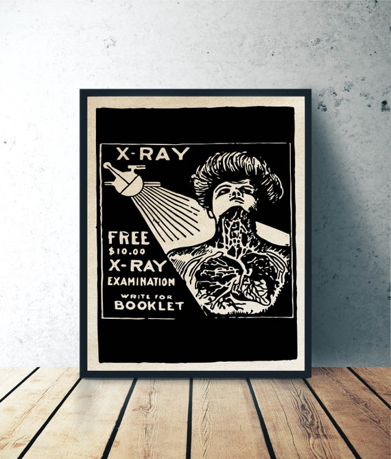 Vintage X-ray Digital Poster 1917 INSTANT DOWNLOAD | Etsy