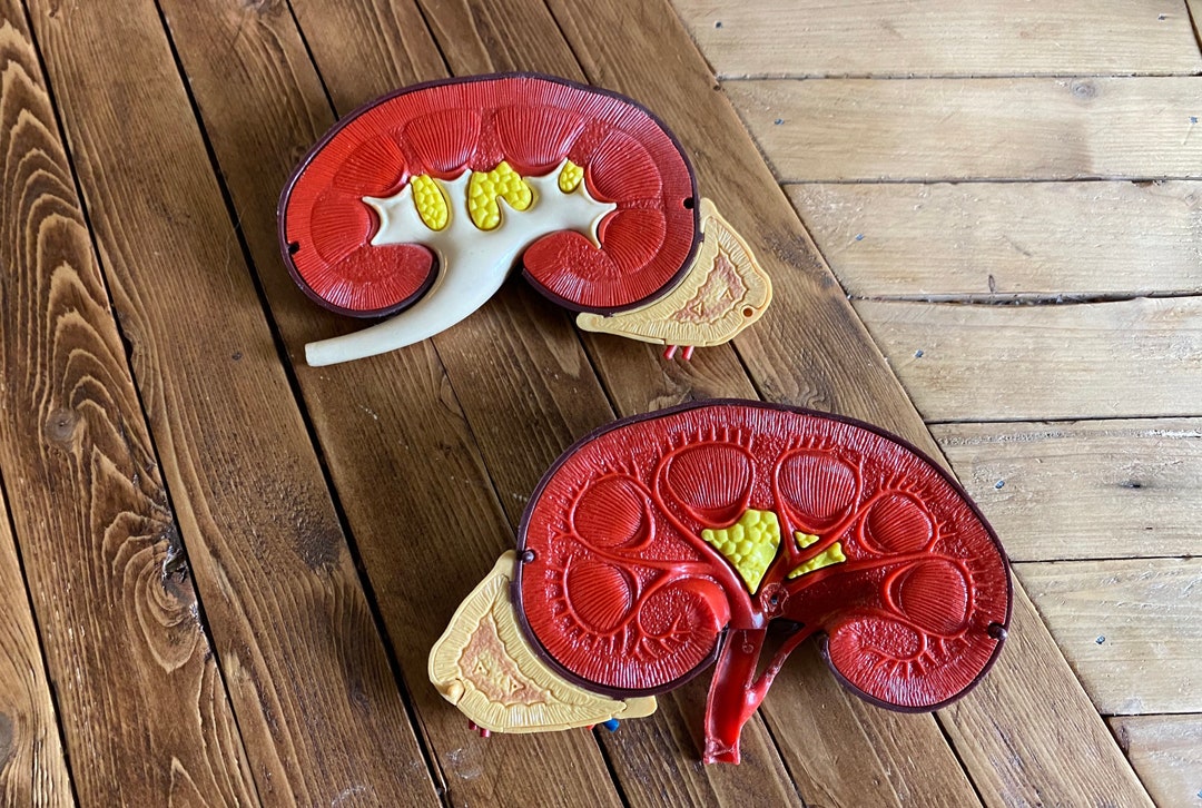Vintage 1960s Anatomical Kidney Model Display - Etsy