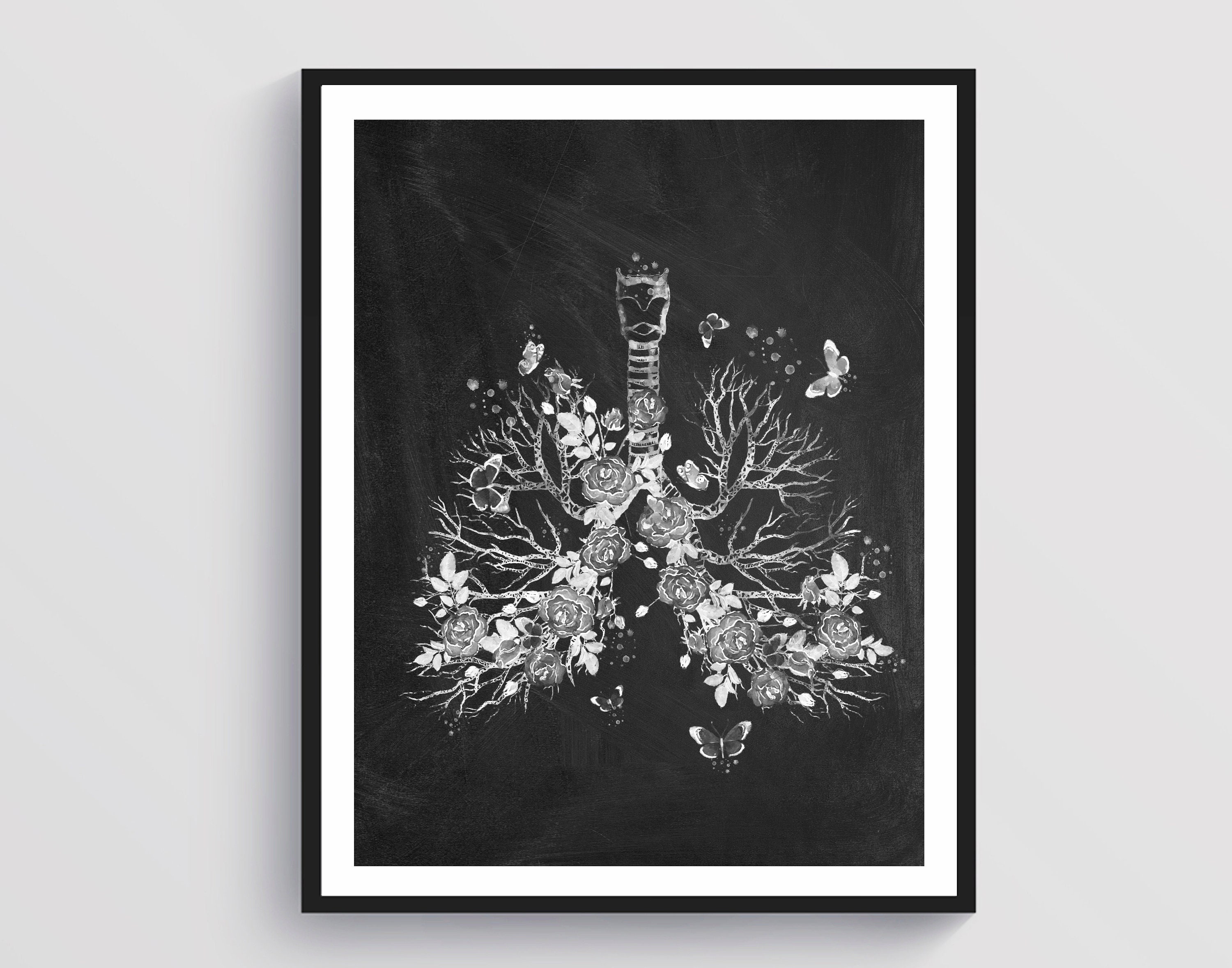 Bronchial Tree Art Lungs Anatomy Art Respiratory System Art ...