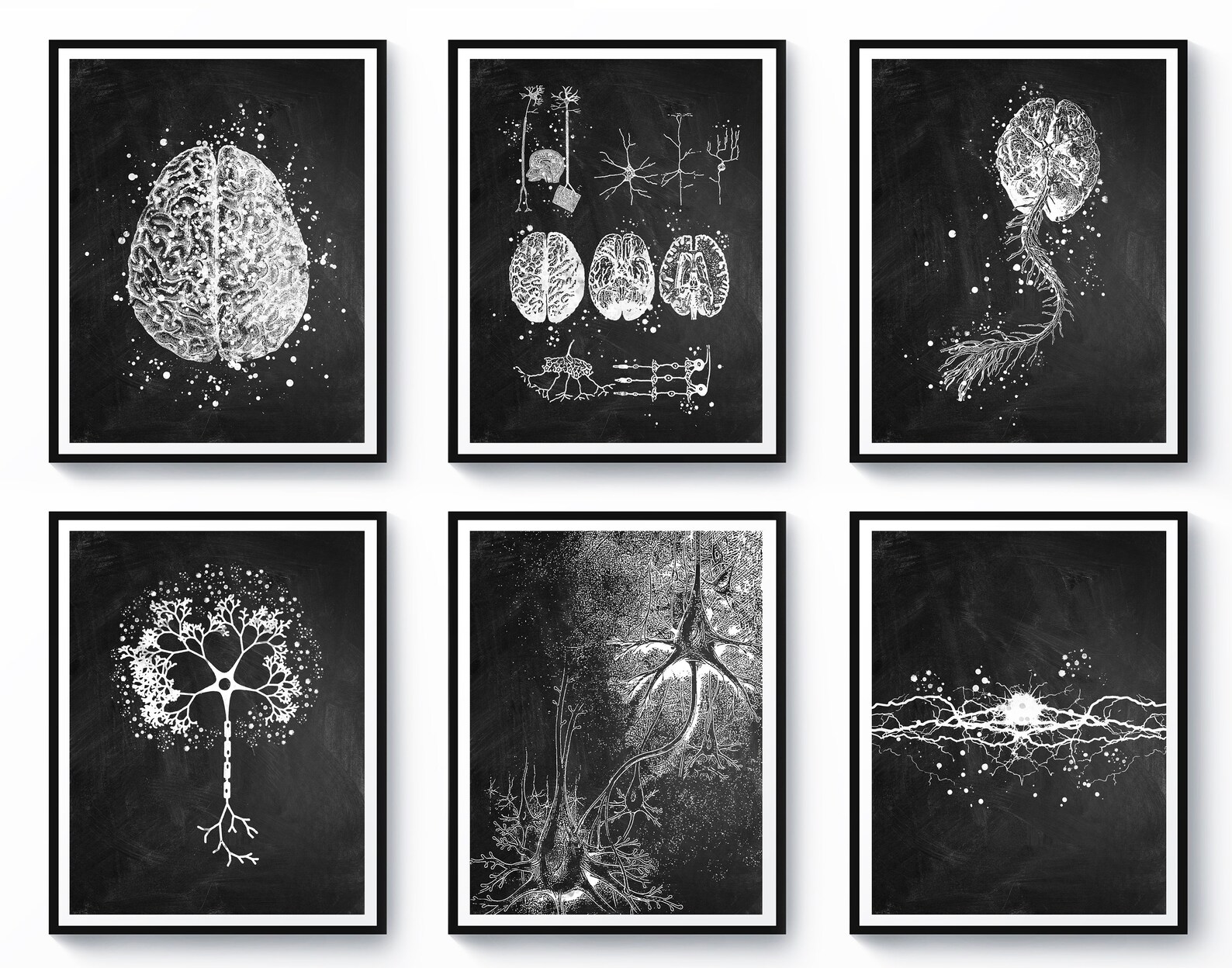 Neurology Art Set 6 Anatomy Chalkboard Drawing Medical Art - Etsy