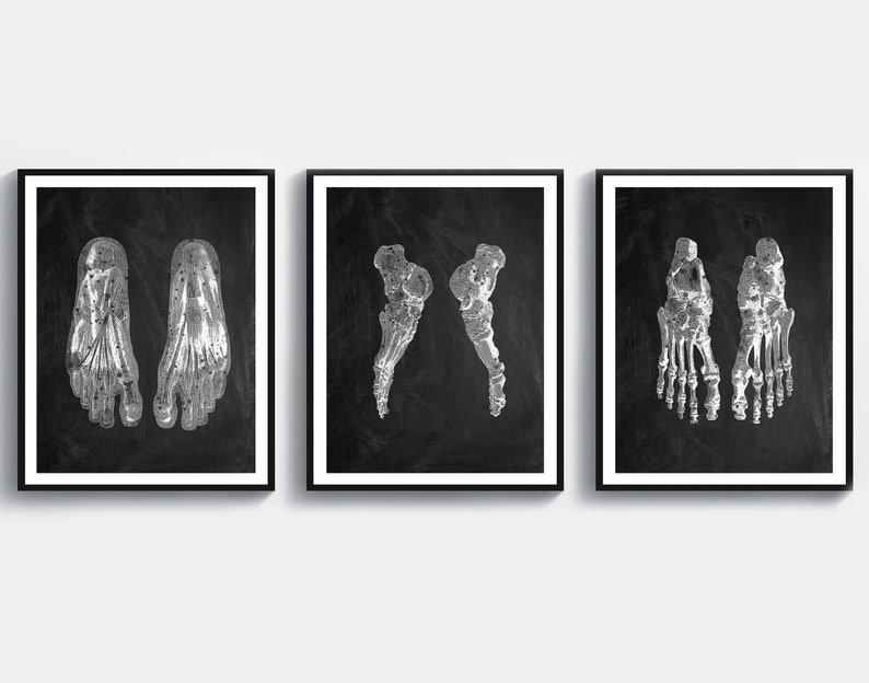3 Chalkboard Anatomy Art Foot Bones Podiatrist Office Gift Orthopedic ...