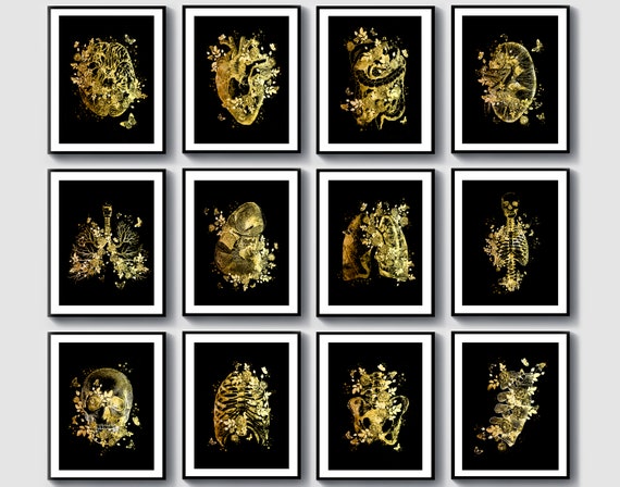 12 Gold Anatomy Art Gold Black Medical Decor Floral Anatomical - Etsy