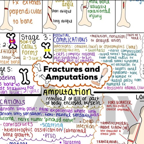 Fractures & Amputations One-page Outline / Concept Map - Etsy