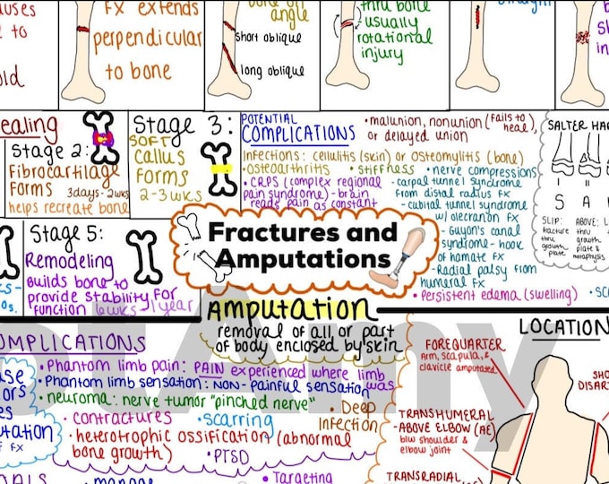 Fractures & Amputations One-page Outline / Concept Map - Etsy
