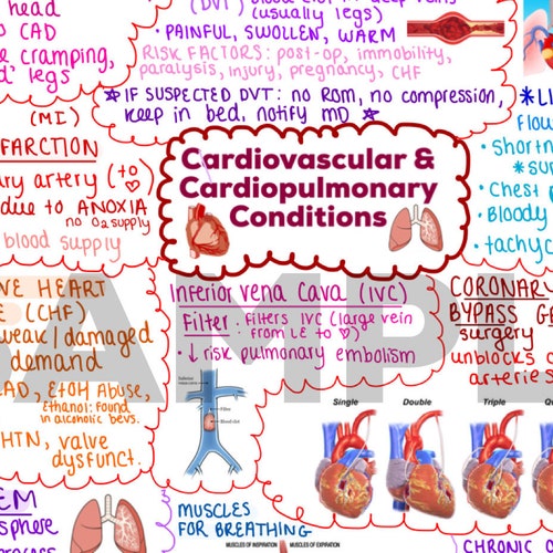 Cardiovascular & Cardiopulmonary Conditions One-page Outline / - Etsy