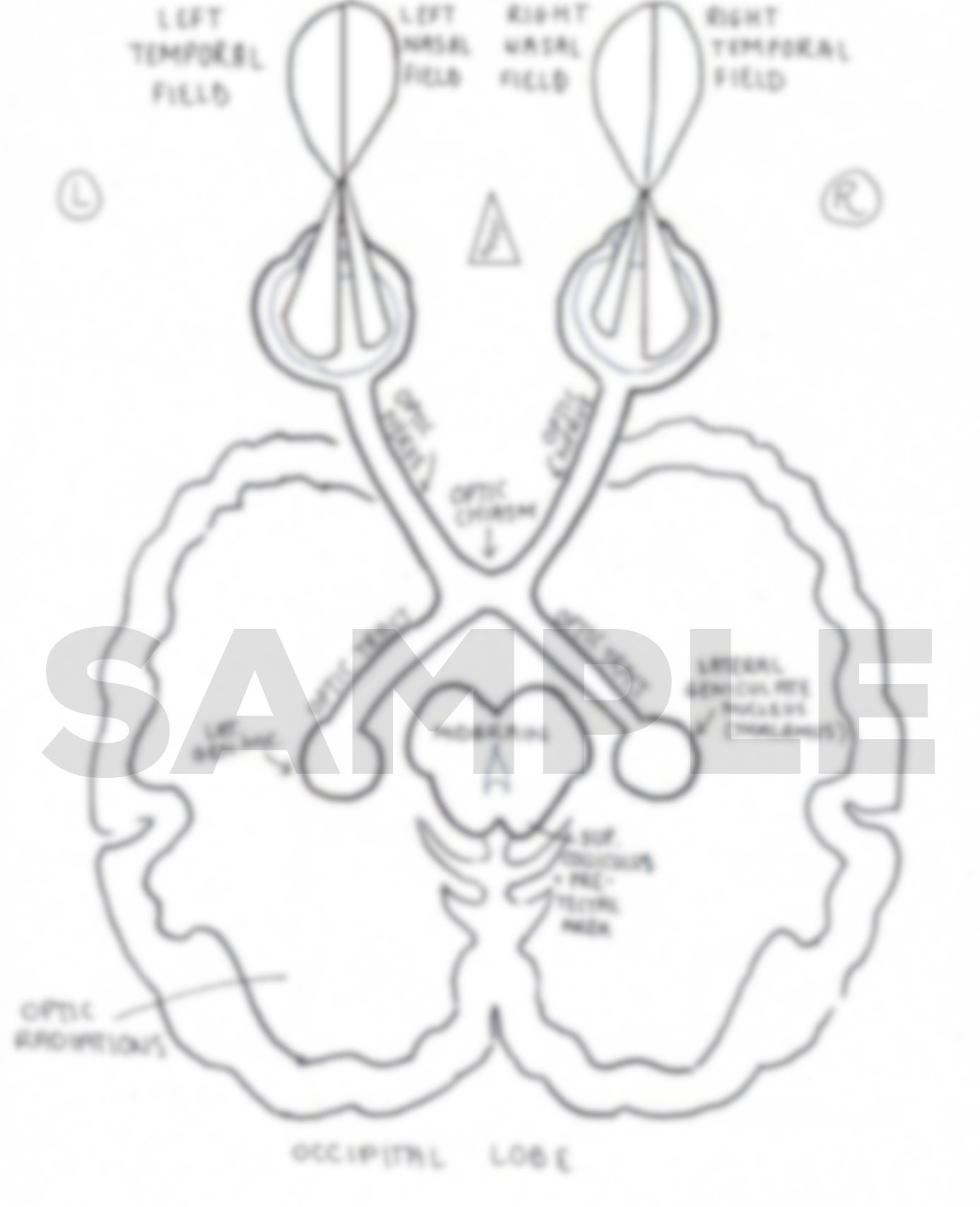 Visual Pathways Diagram, Templates, & Lesions Chart - Etsy