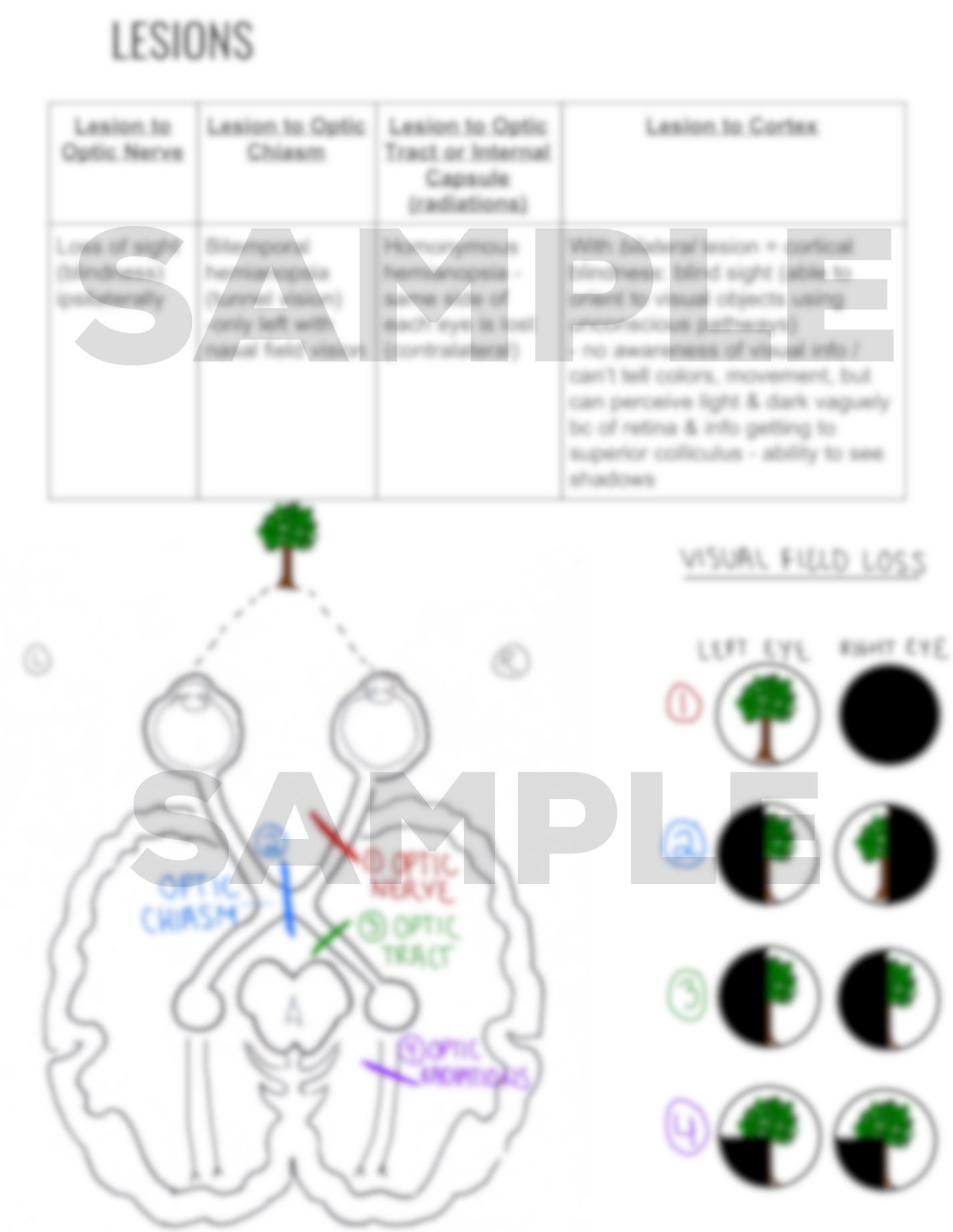 Visual Pathways Diagram, Templates, & Lesions Chart - Etsy