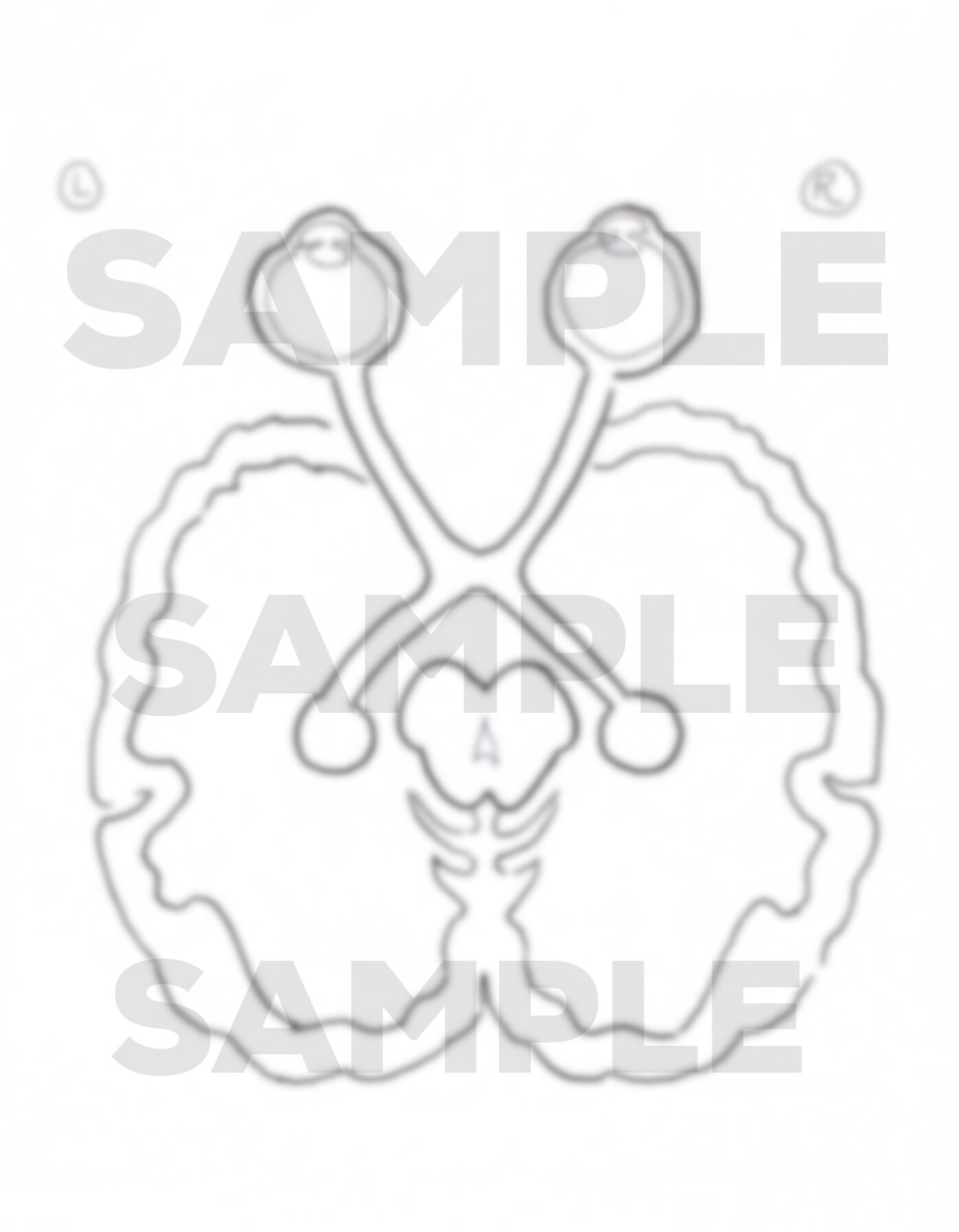 Visual Pathways Diagram, Templates, & Lesions Chart - Etsy