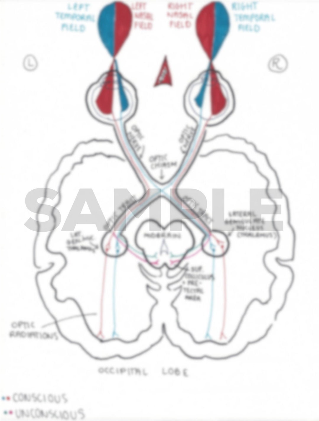 Visual Pathways Diagram, Templates, & Lesions Chart - Etsy