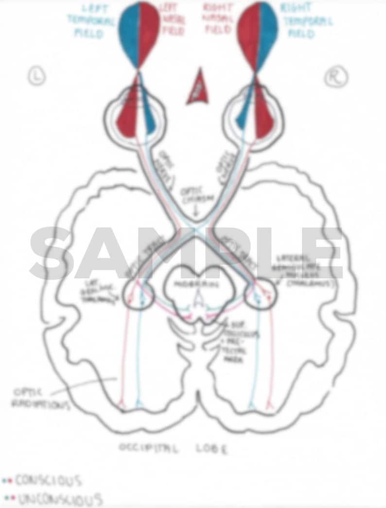 Visual Pathways Diagram, Templates, & Lesions Chart - Etsy