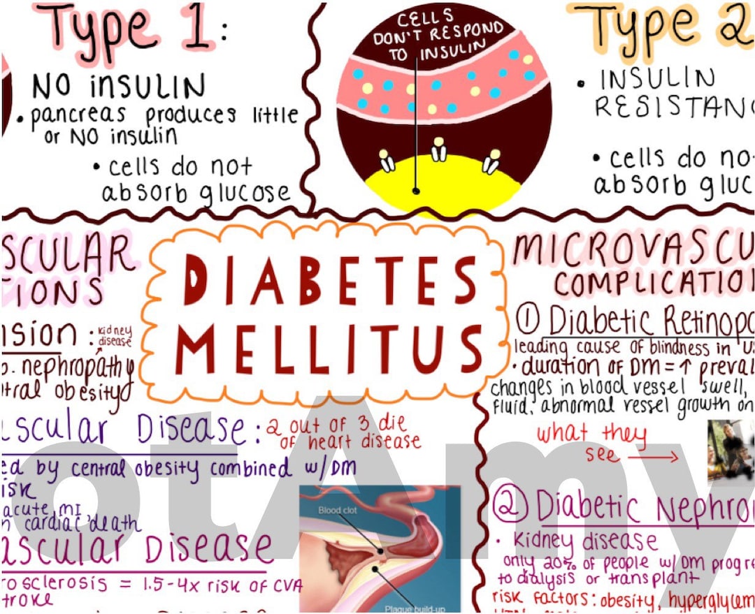 Diabetes Mellitus One-page Outline / Concept Map - Etsy