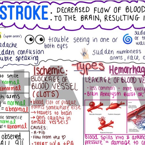 Stroke One-page Outline / Concept Map - Etsy