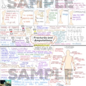 Fractures & Amputations One-page Outline / Concept Map (2-in-1) - Etsy