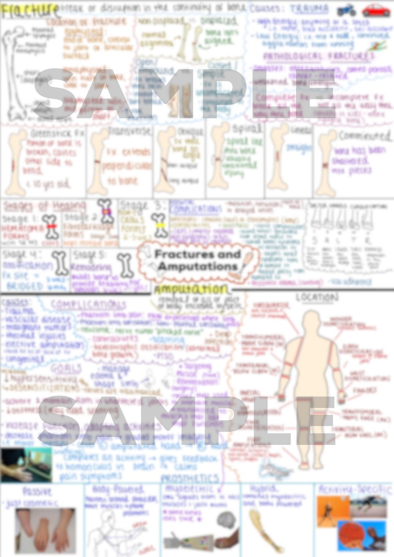 Fractures & Amputations One-page Outline / Concept Map (2-in-1) - Etsy