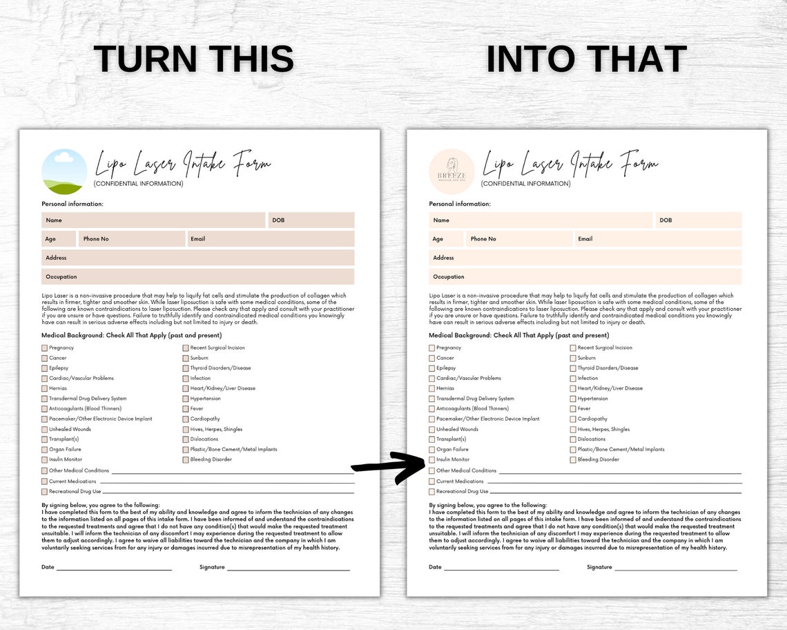 Editable Lipo Laser Form Body Sculpting Form Consent Form - Etsy Australia