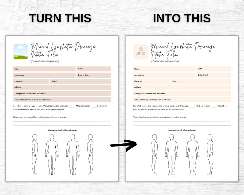 Editable MLD Manual Lymphatic Drainage Intake Form Informed - Etsy