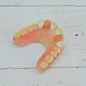 Vintage Jaw Casting, Dentist Teeth Model, Denture 1970s - Etsy