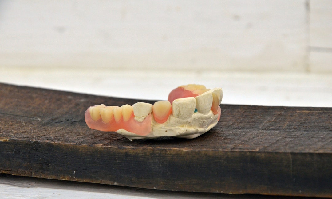 Vintage Jaw Casting, Dentist Teeth Model, Denture 1970s - Etsy