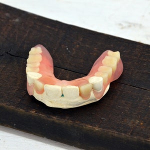 Vintage Jaw Casting, Dentist Teeth Model, Denture 1970s - Etsy