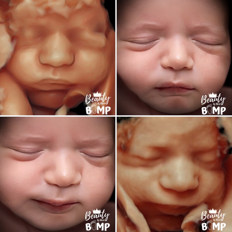 ONE PICTURE 8K Realistic Ultrasound Picture 8D Sonogram Photo - Etsy