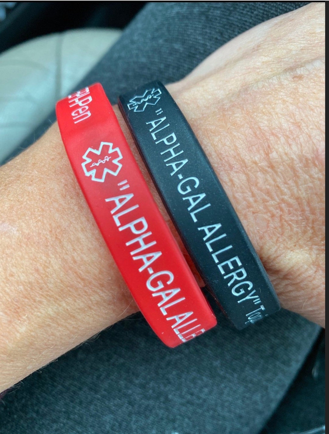 Medical Alert “alpha-gal” Allergy Band - Etsy