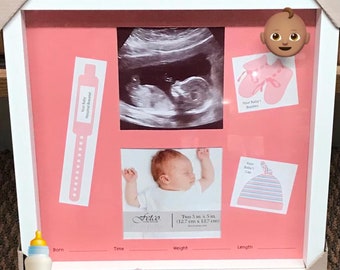 Baby Shadow Box - Etsy