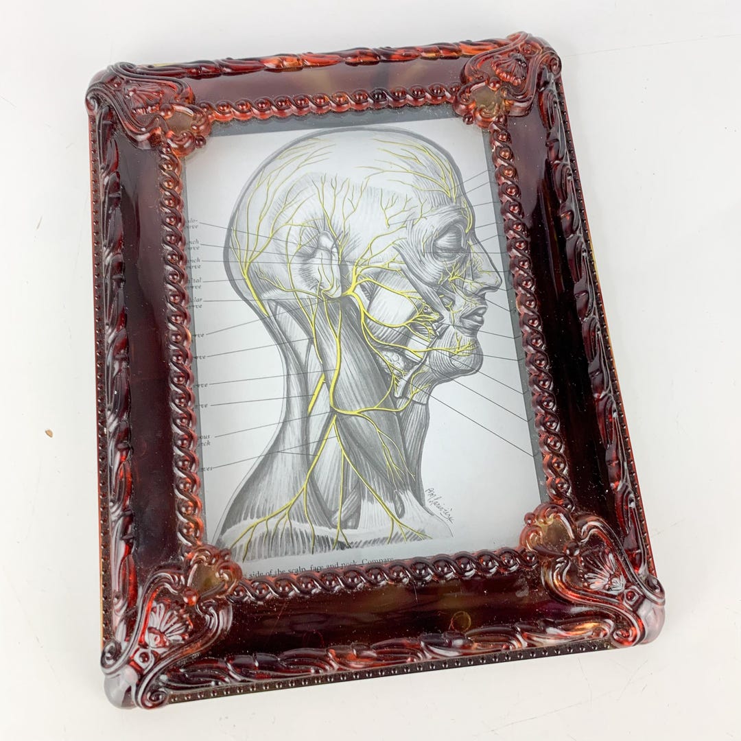 Vintage Brown Plastic Ornate Frame Anatomical Facial Nerve Anatomy Book ...