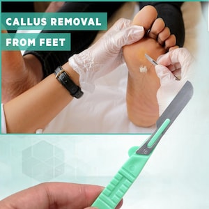 Skin Care Disposable Scalpels #16 Carbon Steel Blades for Dermaplaning ...