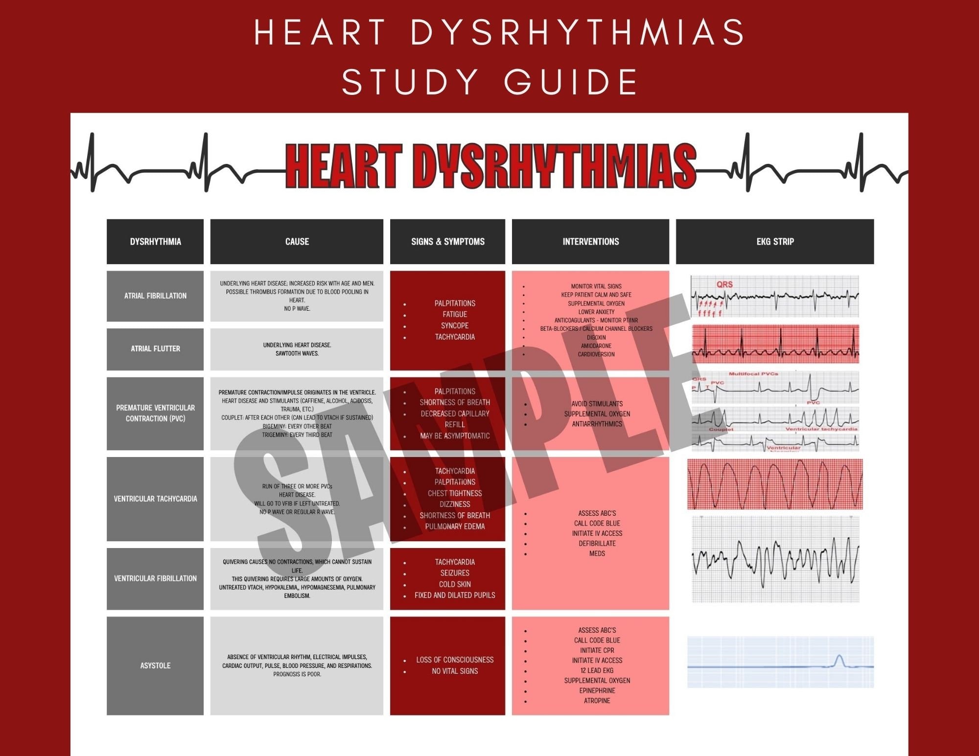 Nursing Student Heart Dysrhythmias Study Guide Notes – School Printable ...